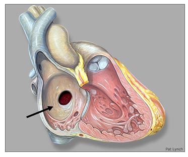 She is born with a hole in her heart. Help her before its late!